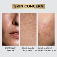 China OEM ODM Brand ExosomeFacial Serum essence Nicotinamide Anti aging Acne Control Centella B5 AHA+BHA+PHA Pore Shrinkage Oil Skin Care Serum for sale