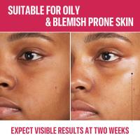 China OEM ODM Brand Customized Skincare Set Anti-Dark Spot Facial Hydrating Toner Vitamin C Brightening Serum Whitening Essence Face Cream Skincare for sale