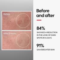 China OEM ODM brand 40% VCIP Niacinemide skin care set anti-aging facial serum skin care product whitening anti wrinkle pore shrink facial essence face cream facial cleanser for sale