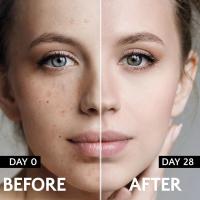 China OEM ODM brand 40% VCIP Niacinemide skin care set anti-aging facial serum skin care product whitening anti wrinkle pore shrink facial essence face cream facial cleanser for sale