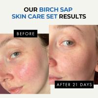 China OEM ODM Brand Skin Care Set Natural Birch Juice Facial Serum Sensitive Skin Care Face Cream Collagen Anti aging Moisturizing Reddening Skin Toner Cleanser Facial Cleanser for sale