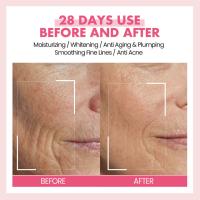 China OEM ODM 5 in 1 Skin Care Facial essence Retinol Vitamin c Whitening Anti aging Wrinkle Reduction Skin Care Facial Serum for sale