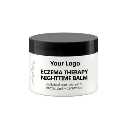 China OEM ODM Brand Natural Skincare Psoriasis Body Cream Eczema Ointment Scalp Hand Fungus Itch Relief Cream for sale