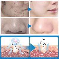 China OEM ODM brand customized natural turmeric kojic acid pad brightening turmeric kojic acid cleaning acne removing skin care essence toner for sale