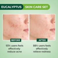 China OEM ODM brand skin care set Eucalyptus facial essence natural soothing and moisturizing acne sensitive skin care facial essence for sale