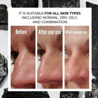China OEM ODM Natural Skin Care Set Brand Customized Blackhead Removing Deep Pore Cleaning Facial Mud facial mask Anti Acne Carbonic Acid foam Clay facial mask for sale