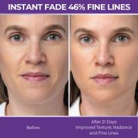 China OEM DOM Korean skin care product set Pro xyline hyaluronic acid facial mask skin care moisturizing anti aging wrinkles face cream whitening essence serum for sale