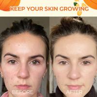 China OEM ODM customized pure skin care essence skin care product pumpkin rose anti-aging wrinkle whitening acne removing serum for sale