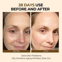 China OEM ODM Korean Organic Skin Care 5 in 1 Urosin Collagen Anti aging Whitening Skin Brightening face cream for sale
