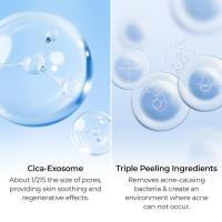 China OEM ODM Skincare Exosomes Aha Bha Salicylic Acid Facial Serum Anti Aging Acne Pore Tightening Facial Peeling Serum for sale