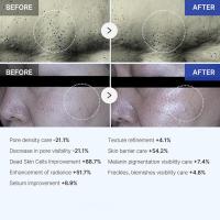 China OEM ODM brand skin care products Anti aging anti wrinkle facial shrinking pores Exosomes skin care facial essence whitening skin care for sale