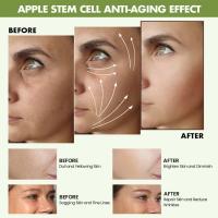 China OEM ODM Korean brand organic skin care product set anti fine lines and wrinkles firming essence to enhance apple stem cell facial moisturizing cream for sale