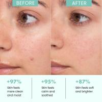 China OEM ODM Acne Skin Cleanser Mild Amino Acid Deep Cleaning Makeup Removing foam Facial Cleanser Beauty Care for sale