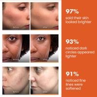 China OEM ODM brand customized skin care serum product whitening black spot remover carrot turmeric facial essence for sale