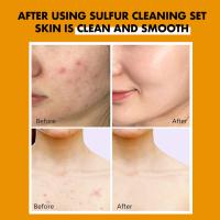 China OEM ODM Korean brand facial cleanser sulfur whitening and acne treatment oil control cleanser shrinks pores and cleanses the face for sale