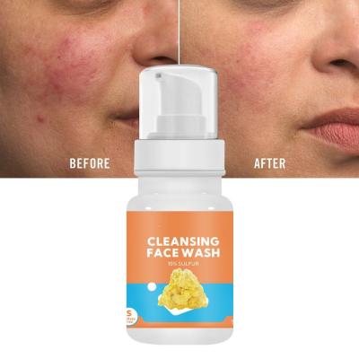 China OEM ODM Korean brand facial cleanser sulfur whitening and acne treatment oil control cleanser shrinks pores and cleanses the face for sale