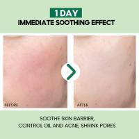 China OEM ODM Korean Organic Facial Skin Care essence Facial Soothing Anti aging Aloe Vera Skin Care Product Facial Anti wrinkle Serum for sale