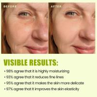 China OEM ODM Korean brand organic natural skincare facial essential oil serum skin rosehip oil anti-aging brightening repair wrinkles skin facial skin essential oil for sale