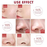 China OEM ODM brand customized yeast water toner facial skincare advanced anti-aging repair acne cleaner skincare products facial toner for sale