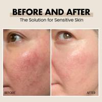 China OEM ODM pure anti sensitive skin face cream skin care product moisturizing deep repair day cream aloe suitable for damaged sensitive skin repair face cream for sale
