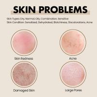 China OEM ODM pure anti sensitive skin face cream skin care product moisturizing deep repair day cream aloe suitable for damaged sensitive skin repair face cream for sale