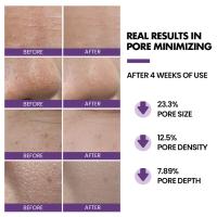 China OEM ODM Deep Cleaning Exfoliating Facial Cleanser Hyaluronic Acid based Pore Minimization Hard Pore Cleanser for sale