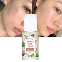 China OEM ODM Sensitive Skin Anti allergic Serum Private brand Organic Skin Care Soothing&Moisturizing Facial essence Repairing Reddening Facial essence for sale
