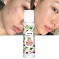 China OEM ODM brand organic sensitive skin care products Anti allergy moisturizing soothing skin face cream lotion for sale