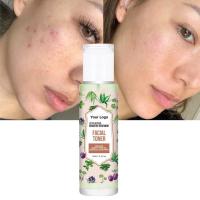 China OEM ODM Sensitive Skin Care Brand Natural Facial Toner Redness Alleviation Anti allergy Moisturizing Facial Toner Soothing spray for sale