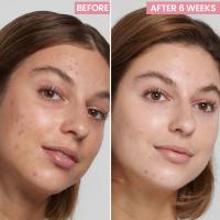 China OEM ODM brand organic skin care face cream beauty product anti-aging facial moisturizing cream collagen wrinkle removing and brightening face cream for sale