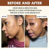 China OEM ODM brand face cream natural anti acne vitamin injection facial moisturizing cream whitening skin care moisturizing moisturizing face cream for sale