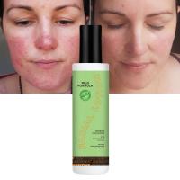 China OEM ODM Brand Customized Organic Anti allergic Moisturizing Repair Facial lotion Moisturizing Cream Sensitive Skin Care Facial Skin Care Product Moisturizing Cream for sale