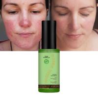 China OEM ODM Brand Organic Vegetarian Serum essence Skin Care Soothing Anti Allergic Facial essence Calming&Repairing Redness essence Liquid for Sensitive Skin for sale