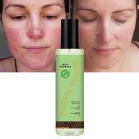 China OEM ODM brand organic pure toner Sensitive skin care product Anti redness, anti allergy, moisturizing facial toner spray soothing agent for sale