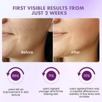 China OEM ODM Retinol Activating Moisturizing Cream Anti aging Facial Skin Care Set Collagen Polypeptide Hyaluronic Acid face cream for sale