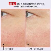 China OEM ODM customized natural repair serum, organic skin care, redness, swelling, damage, relief, facial serum, facial essence for sale