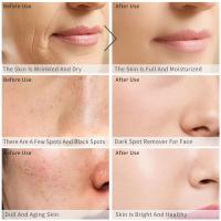 China OEM ODM facial essence capsule Brand skin care product Natural moisturizing hyaluronic acid serum capsule for sale