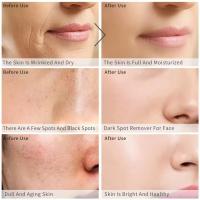 China OEM ODM Brand Facial Serum Capsules Skincare Products Vitamin C Hyaluronic Acid Retinol Whitening and Anti Aging Serum Capsules for sale