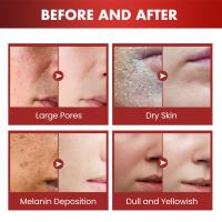 China OEM ODM South Korean brand skin care set face cream manufacturer wholesale dragon blood moisturizing essence serum repair wrinkle skin care product moisturizing cream body lotion for sale