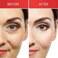 China OEM ODM day and night serum skincare moisturizing anti-aging whitening natural organic vitamin A C retinol 2.5% facial serum for sale