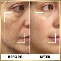 China OEM ODM luxury customized skin care set private brand face cream anti-aging anti wrinkle moisturizing 24k golden essence serum facial mask for sale