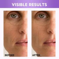 China OEM ODM customized private brand skin care retinol face cream anti-aging wrinkle removal quick repair day and night face cream for sale