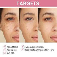 China OEM ODM Korean skin care face cream whitening alpha arbutin whitening face cream black skin whitening anti-aging face cream for sale