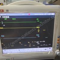 China Biolight BLT Q5 Patient Monitor W/ Printer And LoFlo EtCO2 Monitor For Hospital Medical Equipment for sale