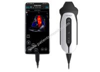 China CHISON SonoEye P3 2.5MHz, Phased Array Digital Color Doppler Palm Ultrasound System P/N: 95-00625-03 for sale