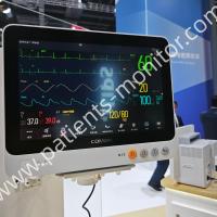 China Comen N12 Patient Monitor Portable Multi-parameter Monitors with 12in Display Screen for sale