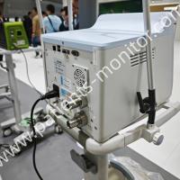 China Comen NV10 Neonatal Ventilator Machine High Frequency for Hospital Portable to Use for sale