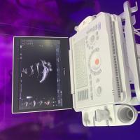 China GE LOGIQ xe Color Doppler Ultrasound Used in Good Working for Hospital Medical for sale