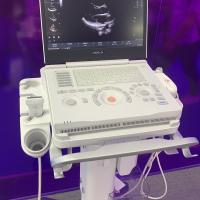 China GE LOGIQ xe Color Doppler Ultrasound Used in Good Working for Hospital Medical for sale