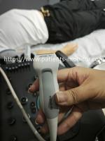 China Mindray SPM6-1U Single Crystal Phased Array Cardiac Ultrasound Probe for Echocardiography and Pediatric Imaging for sale